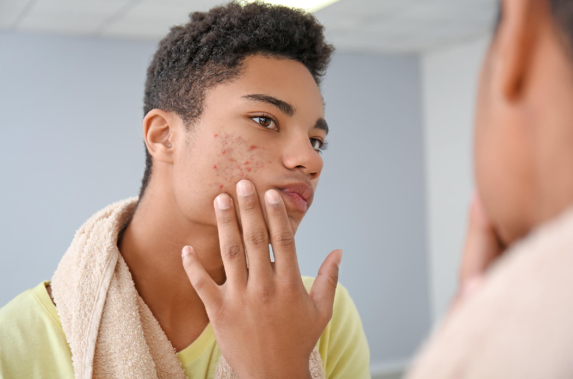 Acne & Acne Treatments | Marquette, MI | Lilly Dermatology